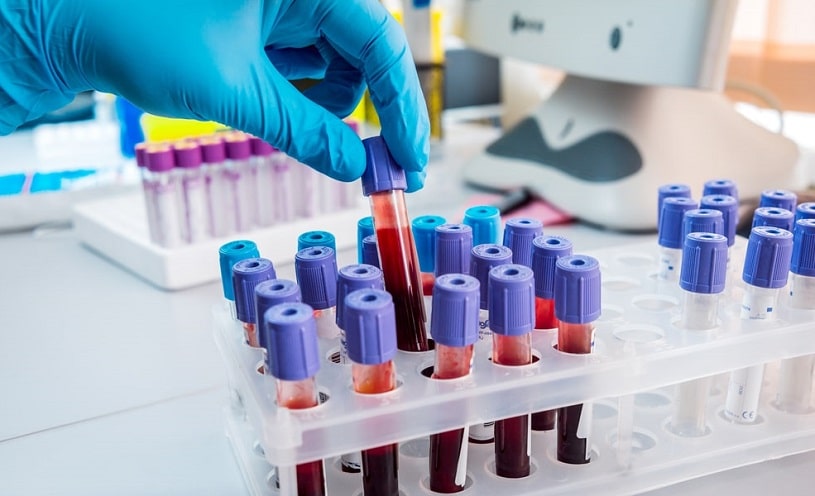 How Long Does Marijuana Stay In Your System? Marijuana Drug Test