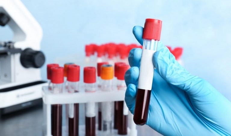 Blood Drug Test: Facts, Pros and Cons, Detection Window