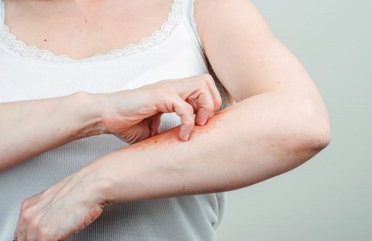 What Are Meth Sores & Meth Mites? How Are They Treated?