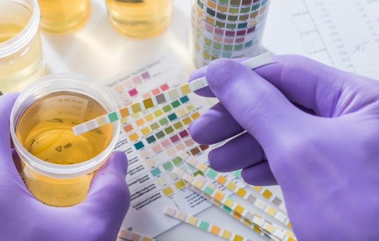 Alcohol (ETG) Testing: What Does Blood Alcohol Level Mean?